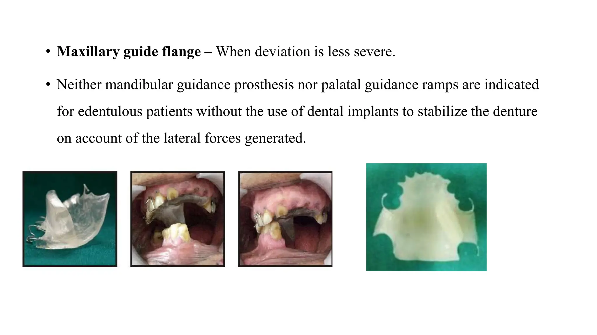 PROSTHODONTIC MANAGEMENT OF MANDIBULAR DEFECTS.pptx