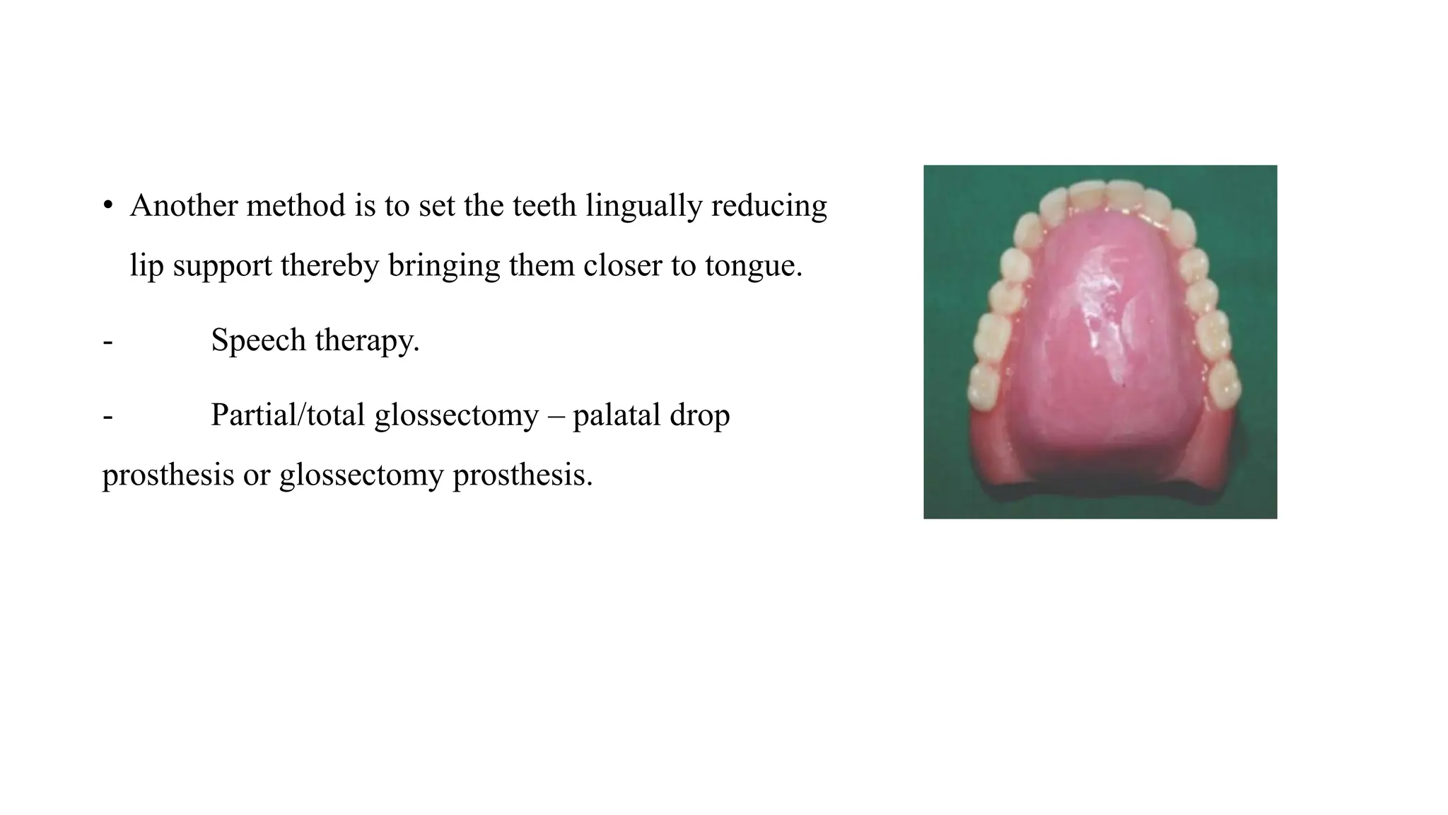 PROSTHODONTIC MANAGEMENT OF MANDIBULAR DEFECTS.pptx