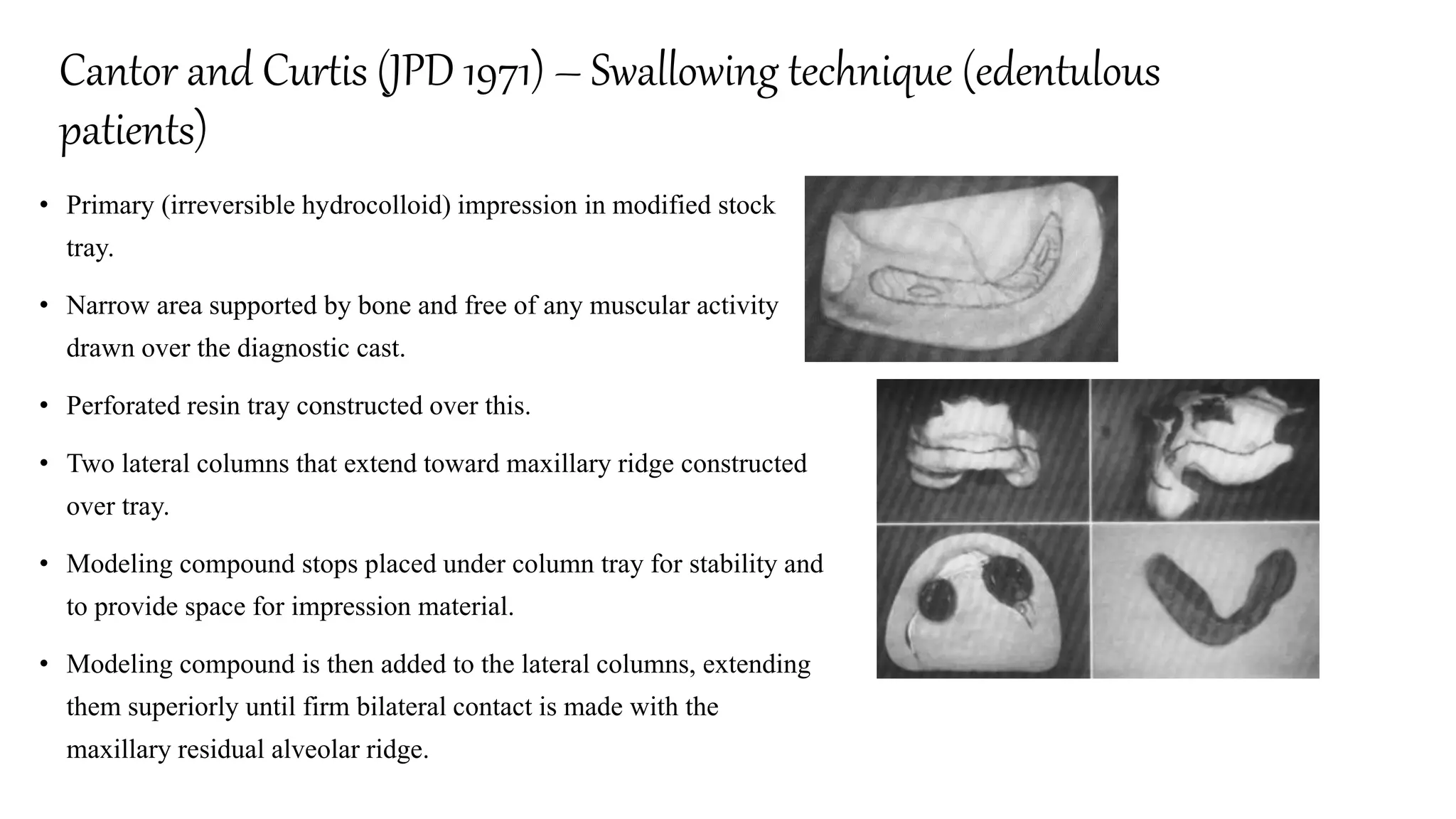 PROSTHODONTIC MANAGEMENT OF MANDIBULAR DEFECTS.pptx