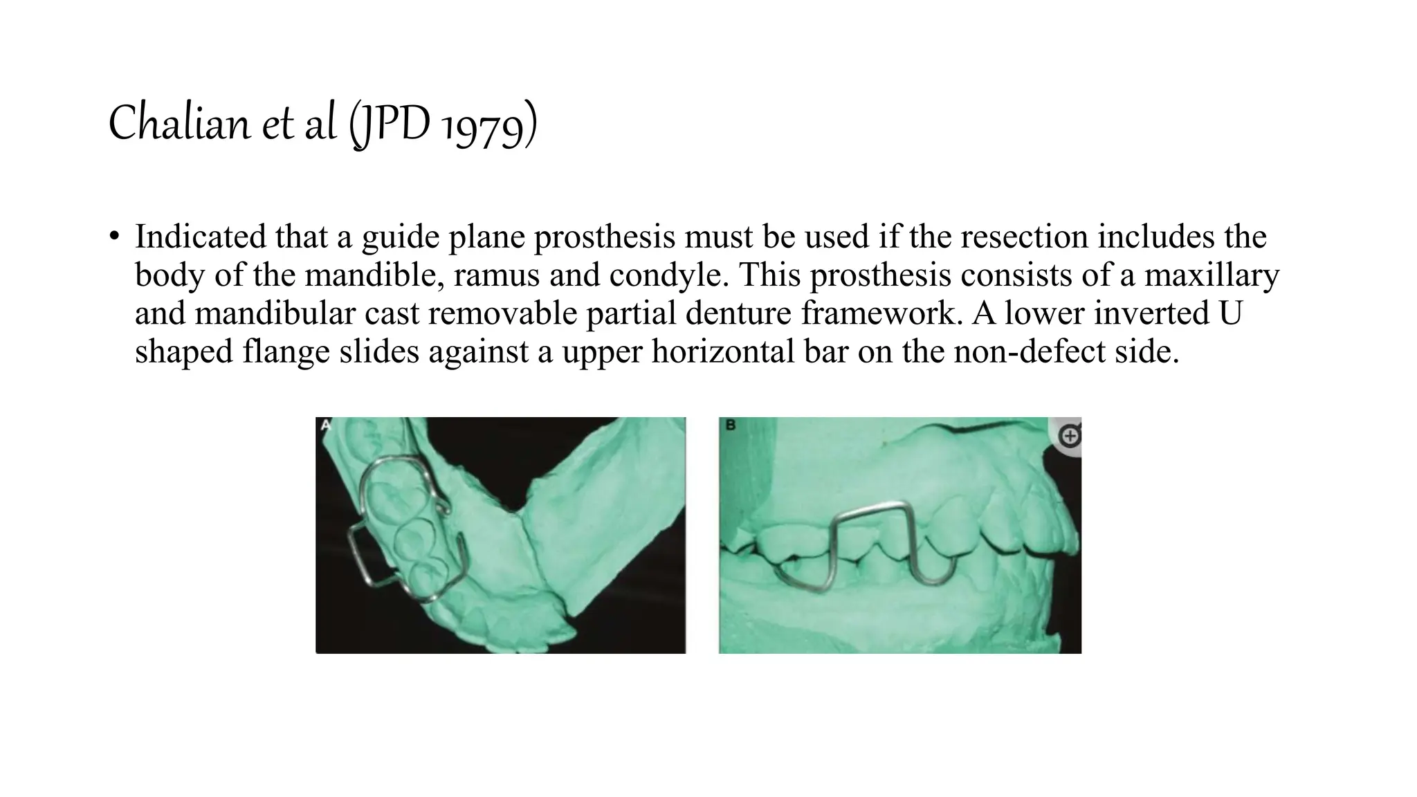 PROSTHODONTIC MANAGEMENT OF MANDIBULAR DEFECTS.pptx