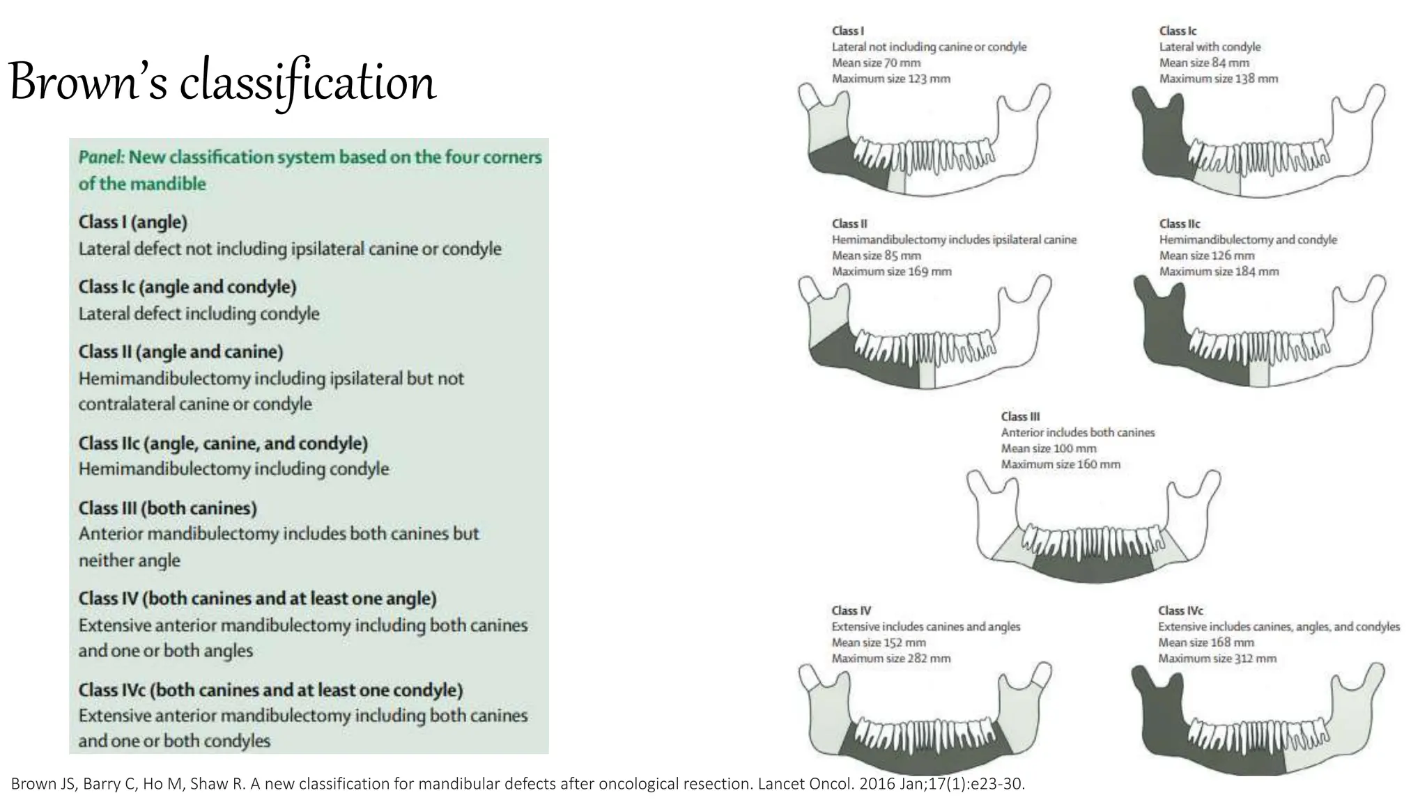 PROSTHODONTIC MANAGEMENT OF MANDIBULAR DEFECTS.pptx