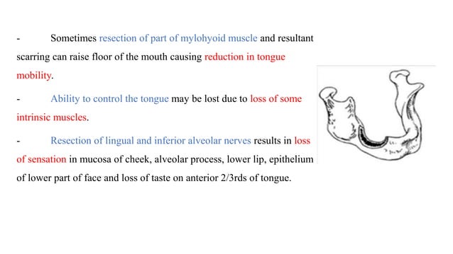 PROSTHODONTIC MANAGEMENT OF MANDIBULAR DEFECTS.pptx | Ear, Nose and ...