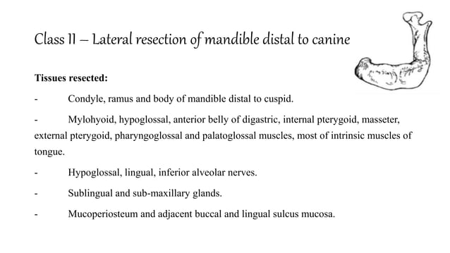 PROSTHODONTIC MANAGEMENT OF MANDIBULAR DEFECTS.pptx | Ear, Nose and ...