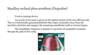 PROSTHODONTIC MANAGEMENT OF MANDIBULAR DEFECTS.pptx