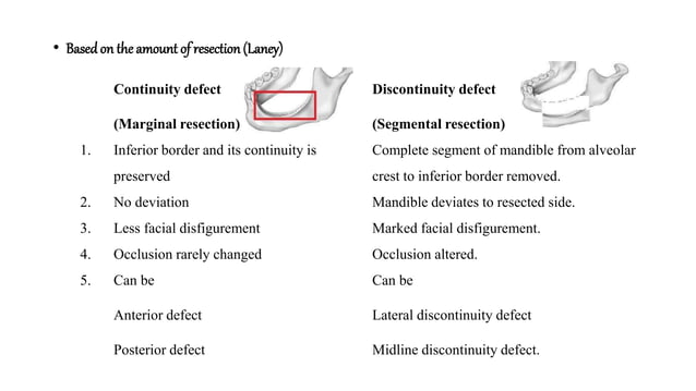 PROSTHODONTIC MANAGEMENT OF MANDIBULAR DEFECTS.pptx | Ear, Nose and ...