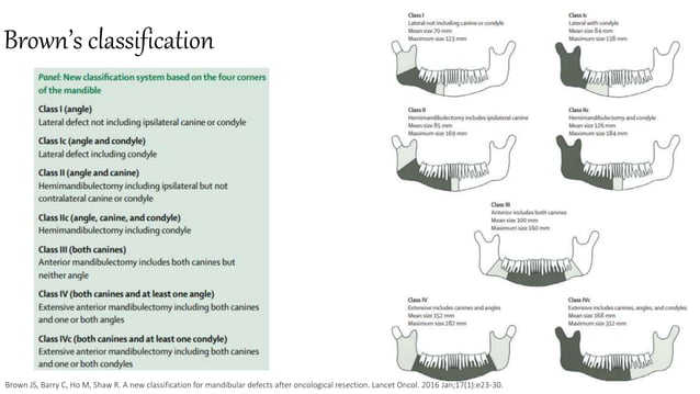 PROSTHODONTIC MANAGEMENT OF MANDIBULAR DEFECTS.pptx | Ear, Nose and ...