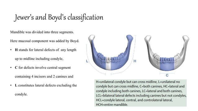 PROSTHODONTIC MANAGEMENT OF MANDIBULAR DEFECTS.pptx | Ear, Nose and ...