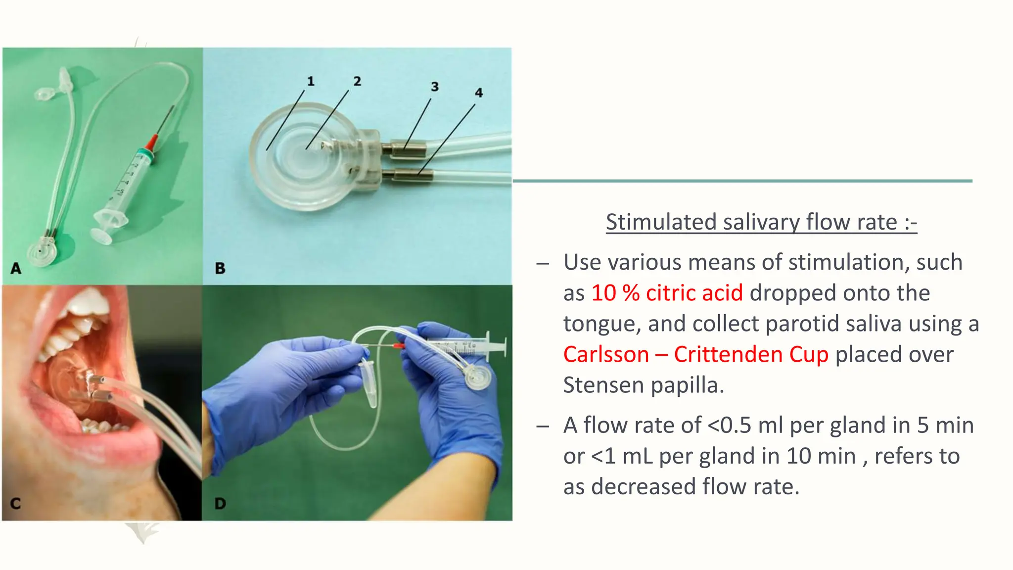 Prosthodontic Management of Xerostomia.pptx