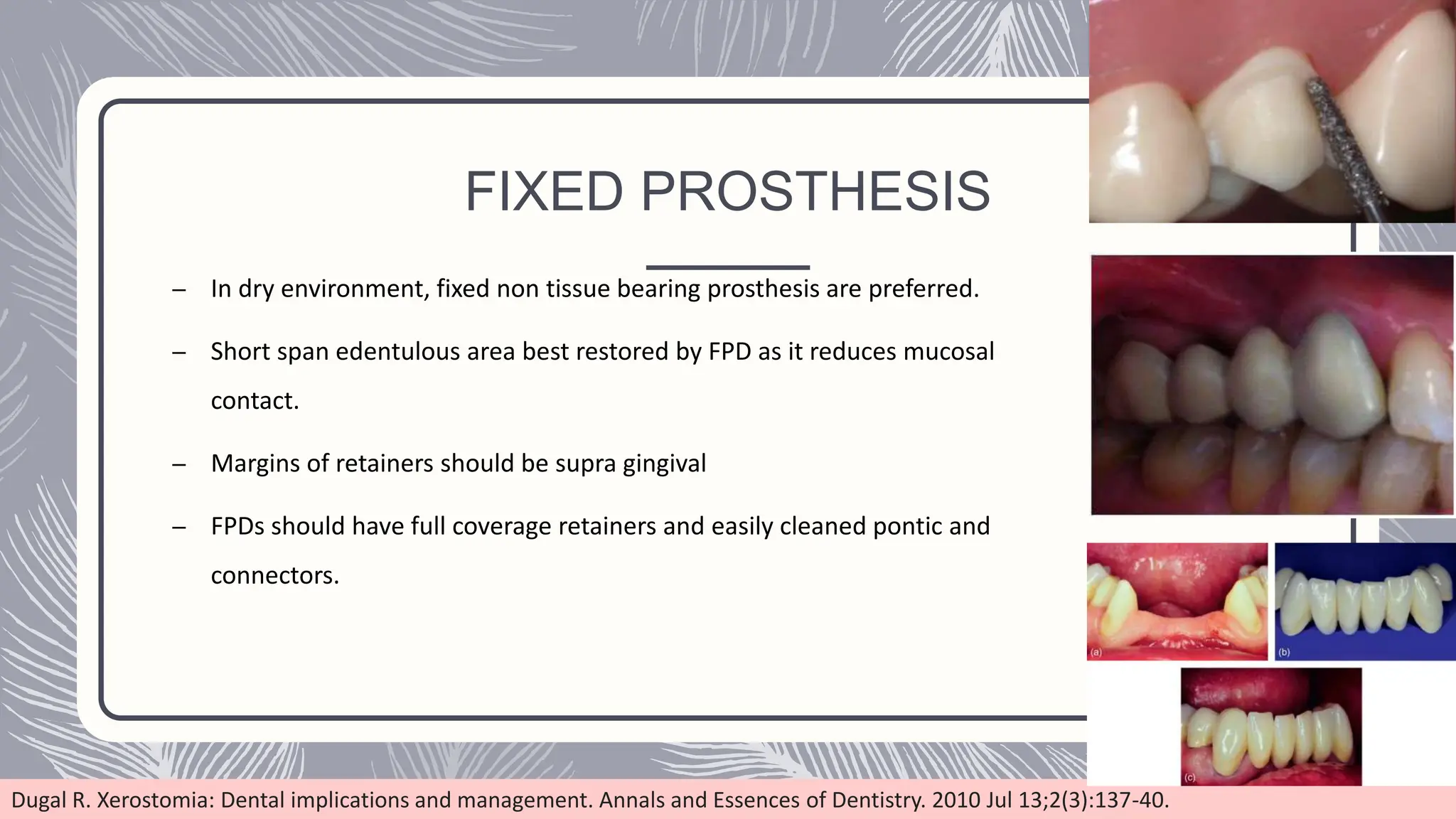 Prosthodontic Management of Xerostomia.pptx