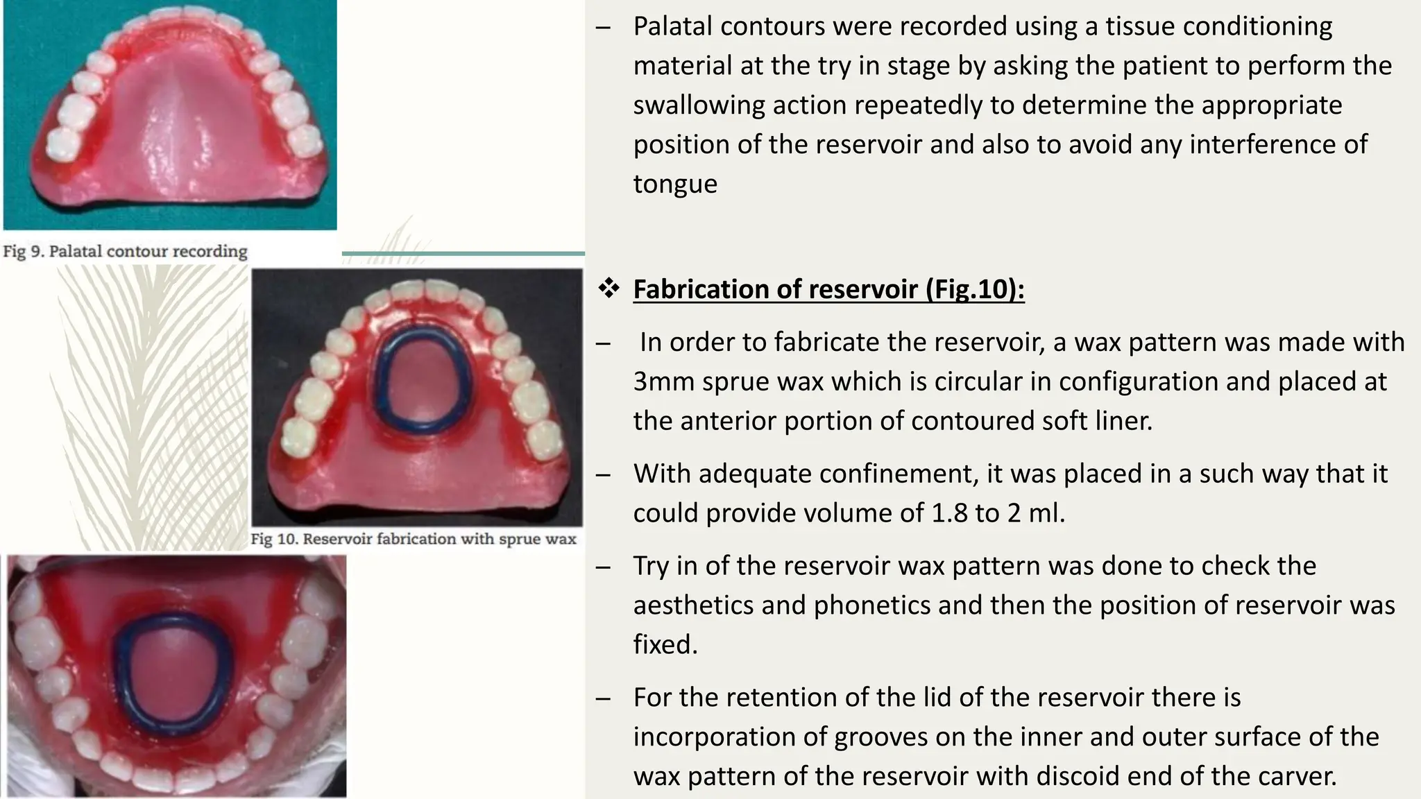 Prosthodontic Management of Xerostomia.pptx