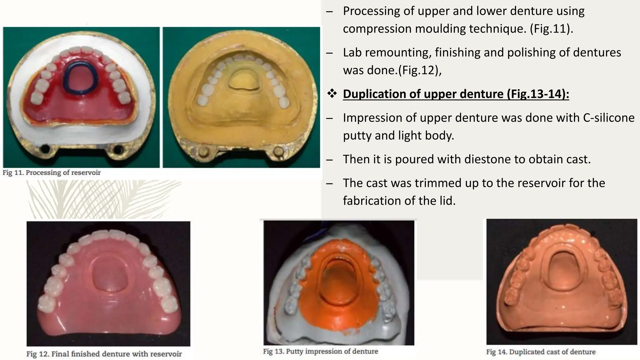 Prosthodontic Management of Xerostomia.pptx