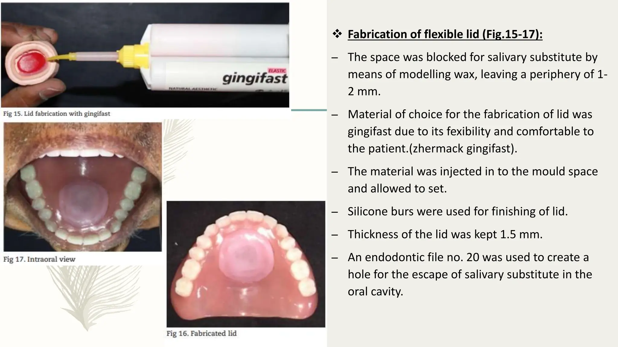 Prosthodontic Management of Xerostomia.pptx