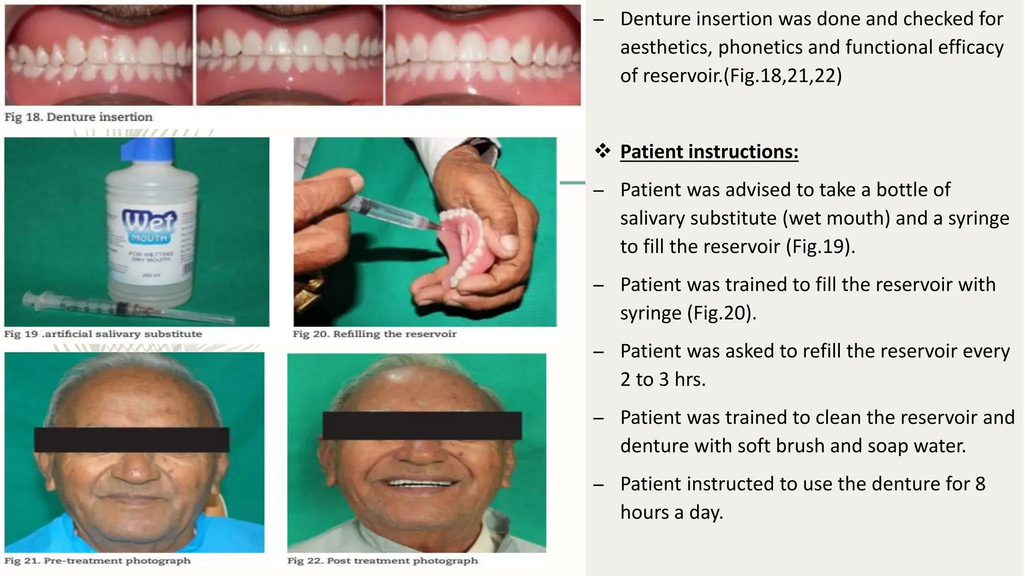 Prosthodontic Management of Xerostomia.pptx