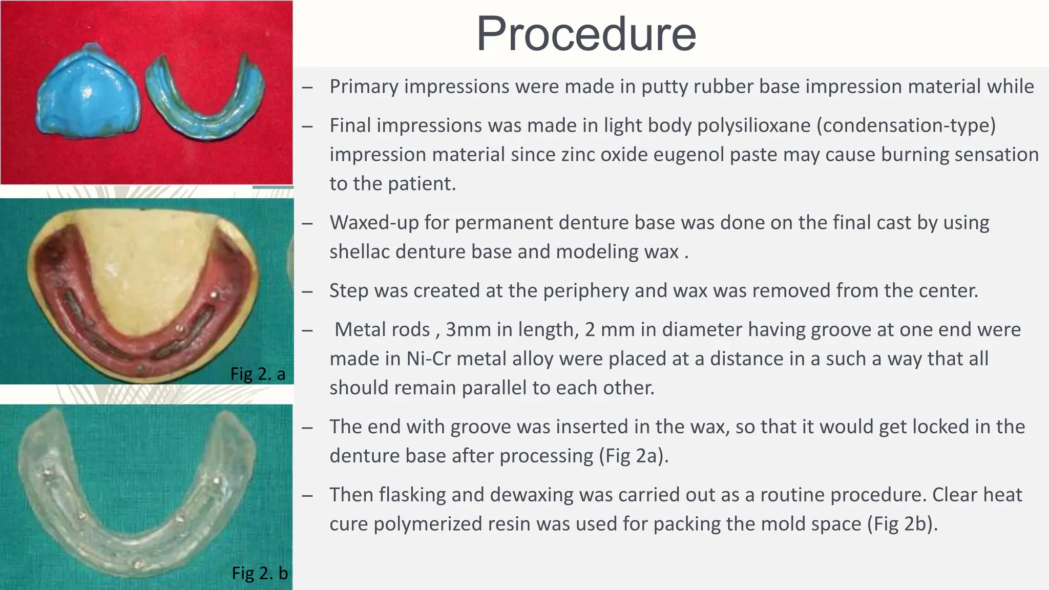Prosthodontic Management of Xerostomia.pptx