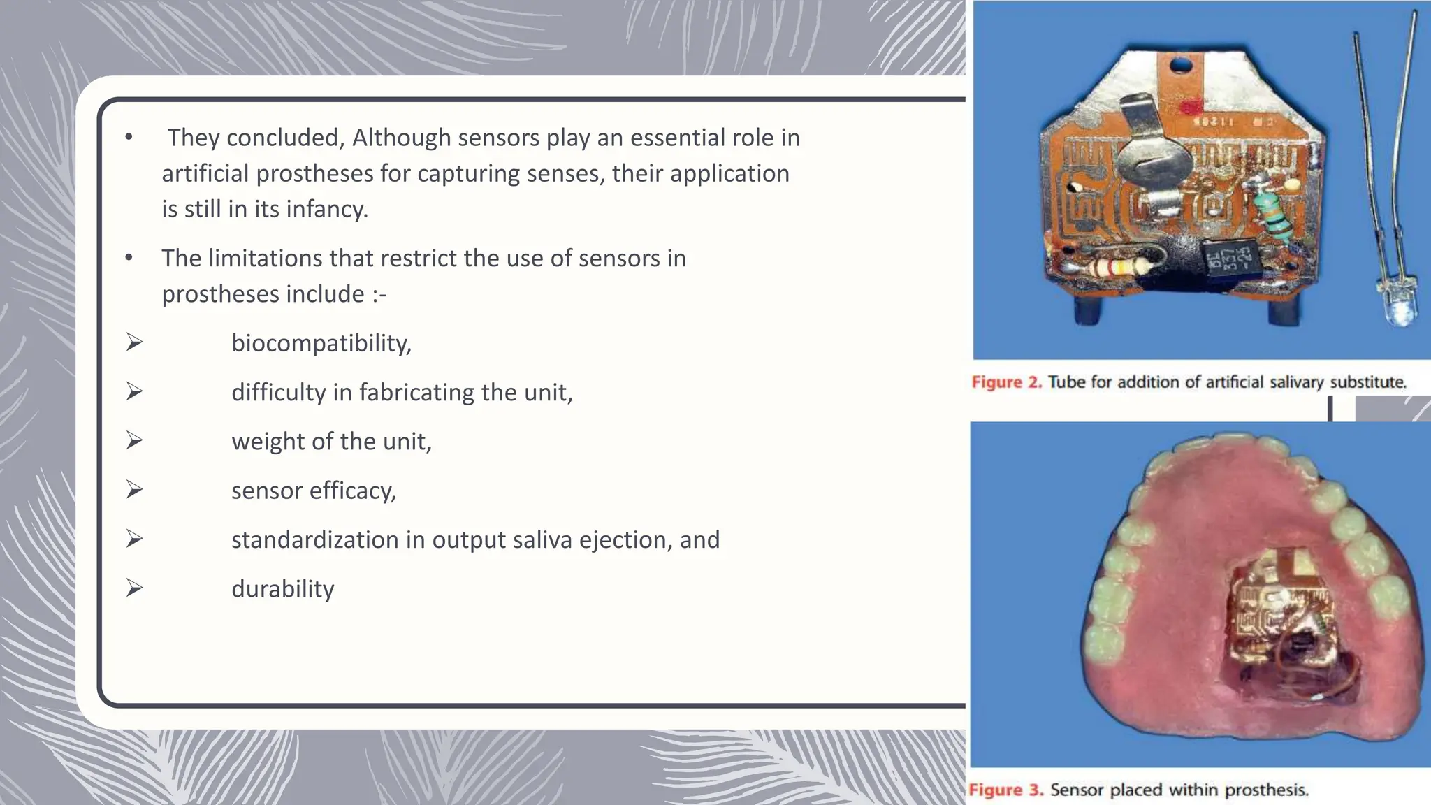 Prosthodontic Management of Xerostomia.pptx