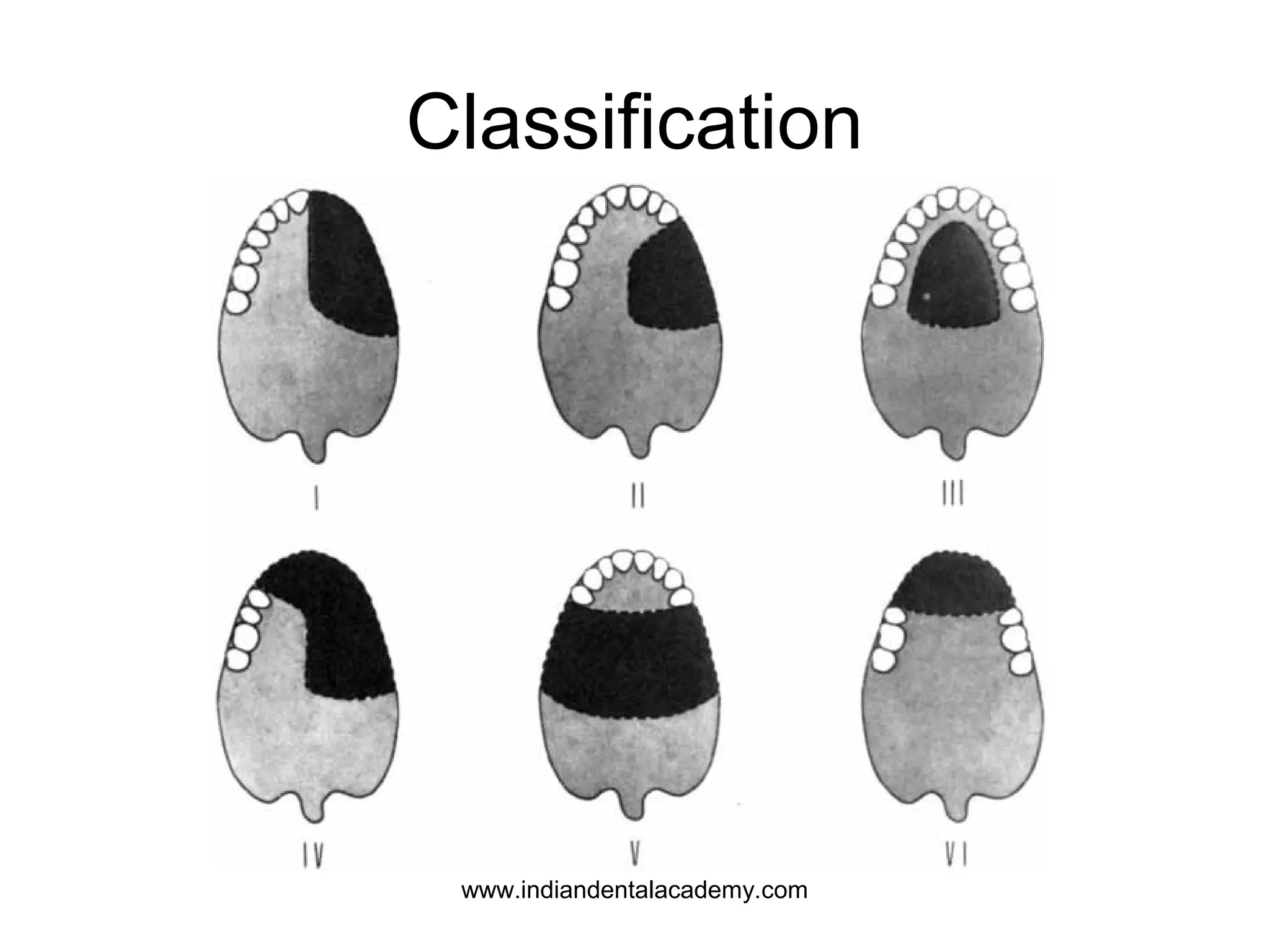 Prosthodontic principles of obturator design.ppt/ dental courses | PPT