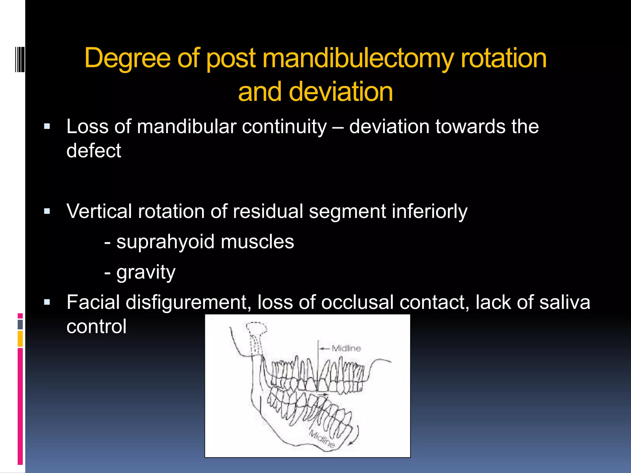 Prosthodontic rehabilitation of mandibulectomy | PPTX