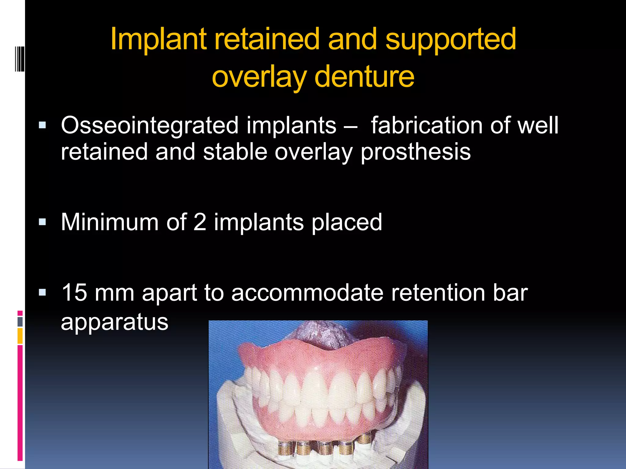 Prosthodontic rehabilitation of mandibulectomy | PPTX