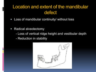 Prosthodontic rehabilitation of mandibulectomy | PPTX