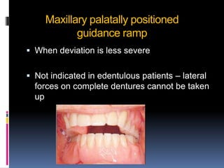 Prosthodontic rehabilitation of mandibulectomy | PPTX