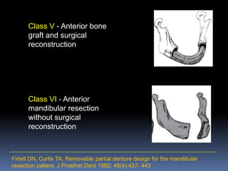 Prosthodontic rehabilitation of mandibulectomy | PPTX