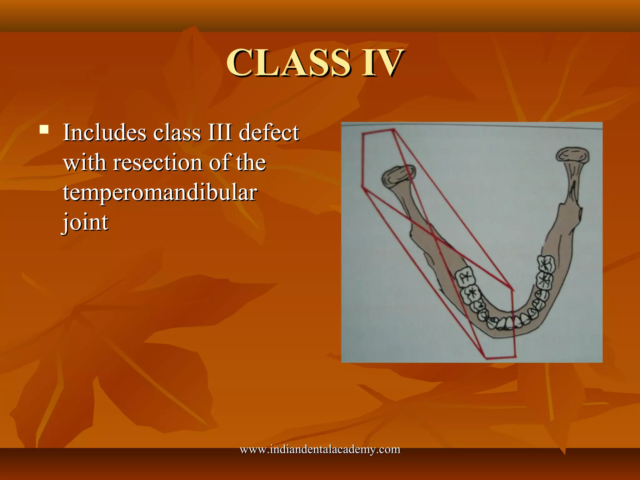 Prosthodontic rehabilitation of the mandibulectomy patient | PPT
