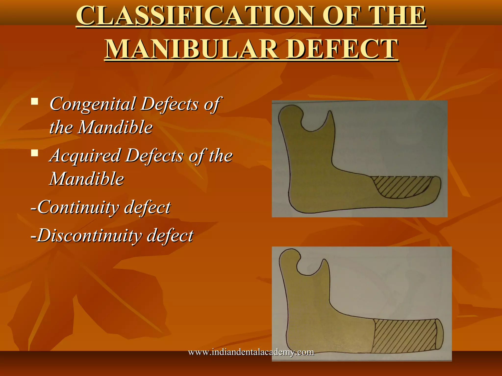 Prosthodontic rehabilitation of the mandibulectomy patient | PPT