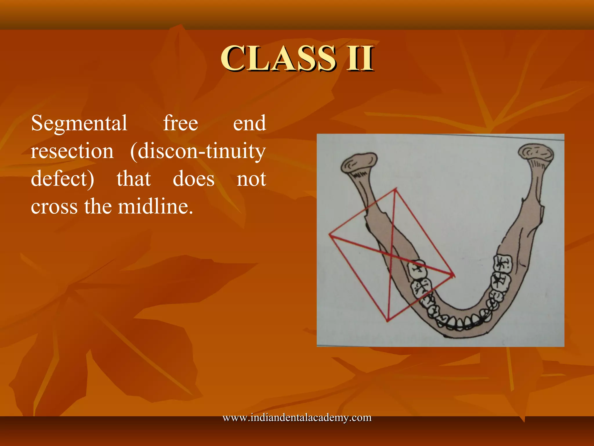 Prosthodontic rehabilitation of the mandibulectomy patient | PPT