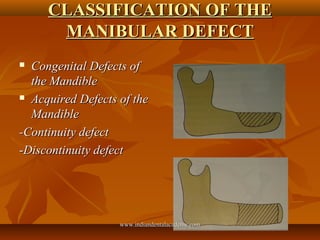 Prosthodontic rehabilitation of the mandibulectomy patient | PPT