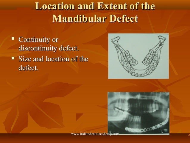 Prosthodontic rehabilitation of the mandibulectomy patient