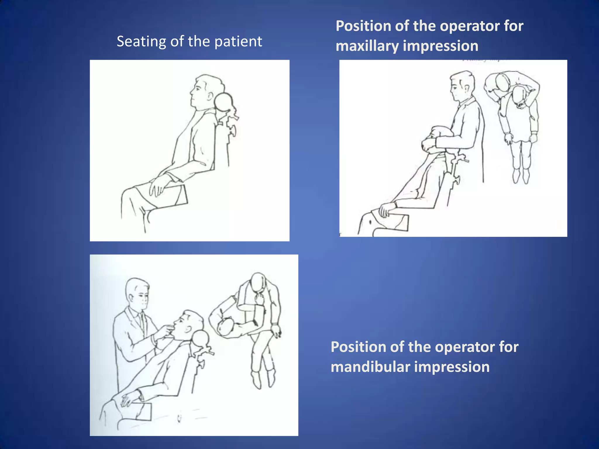 impression techniques of complete denture | PPTX
