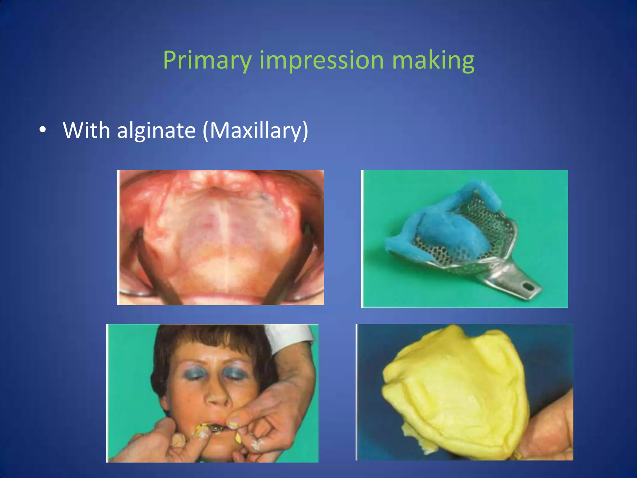 impression techniques of complete denture | PPTX