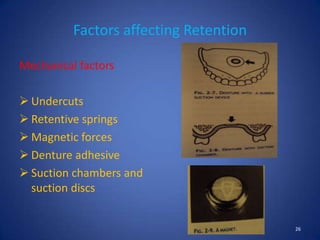 impression techniques of complete denture | PPTX