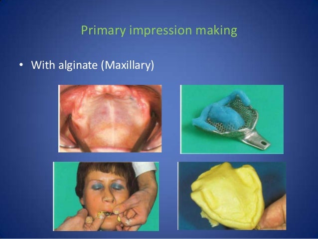 impression techniques of complete denture
