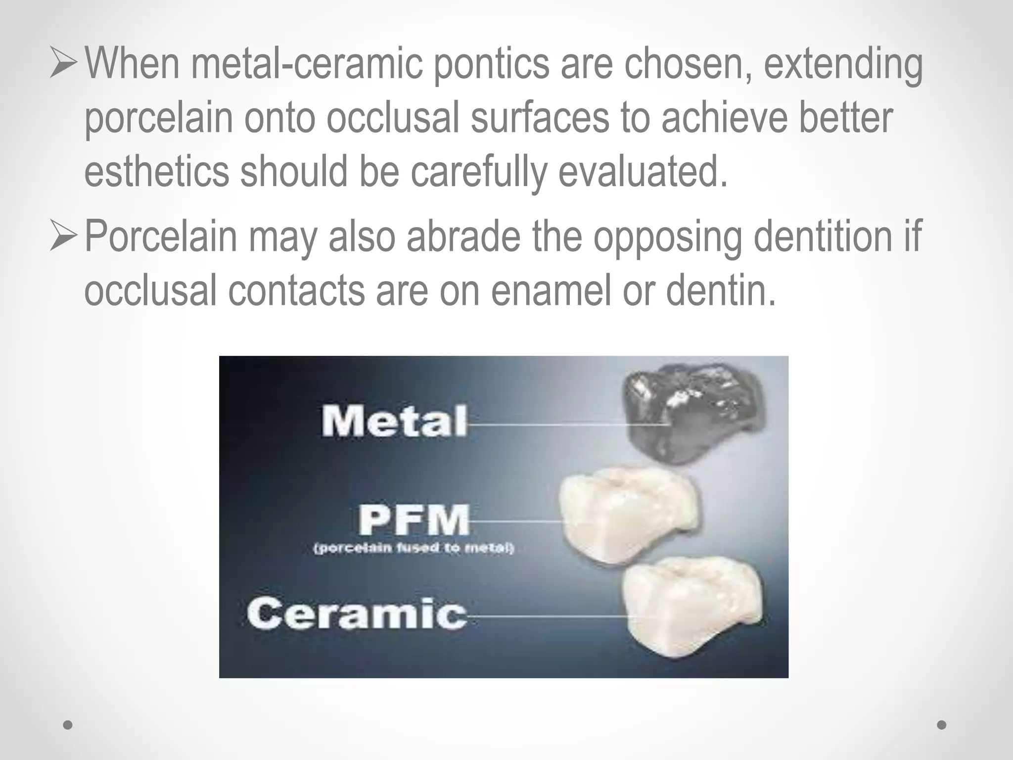 pontics in FPD (prosthodontics) | PPTX
