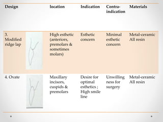 pontics in FPD (prosthodontics) | PPTX