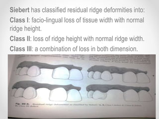 pontics in FPD (prosthodontics) | PPTX | Dental Health | Diseases and ...