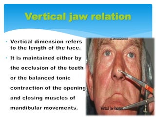 clinical procedure in complete denture | PPTX