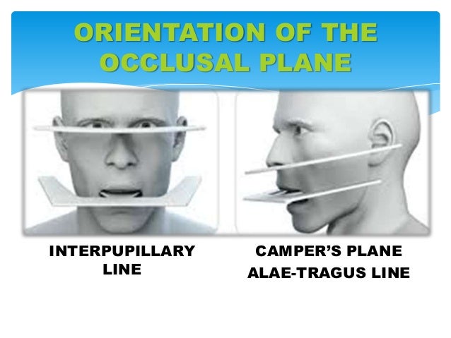 clinical procedure in complete denture