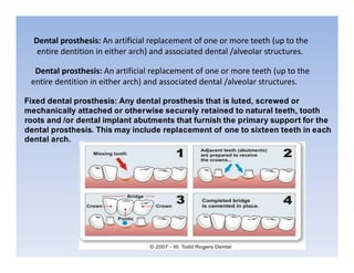 Prosthodontics lec | PDF