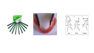 Prosthodontics - realeff relevance in complete denture | PDF