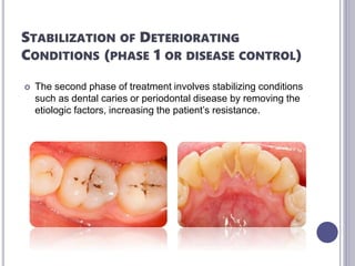 Prosthodontic treatment planning flow chart and communication with ...