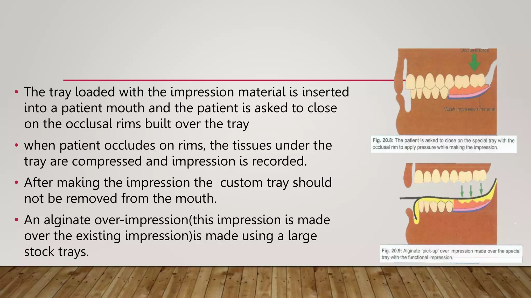 Functional impression in RPD | PPTX