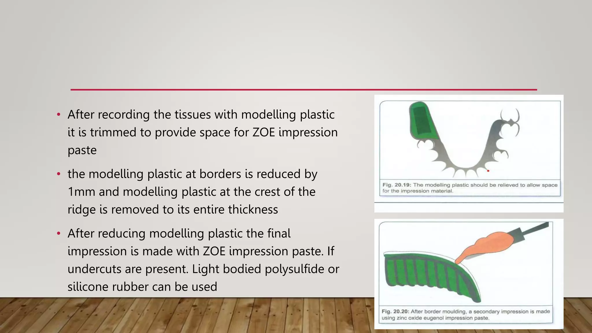 Functional impression in RPD | PPTX