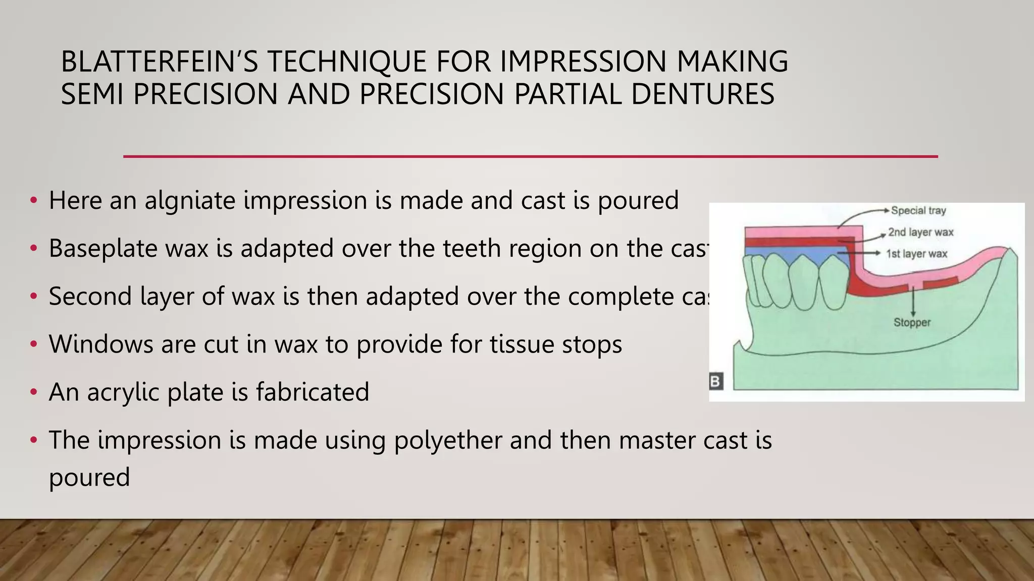 Functional impression in RPD | PPTX
