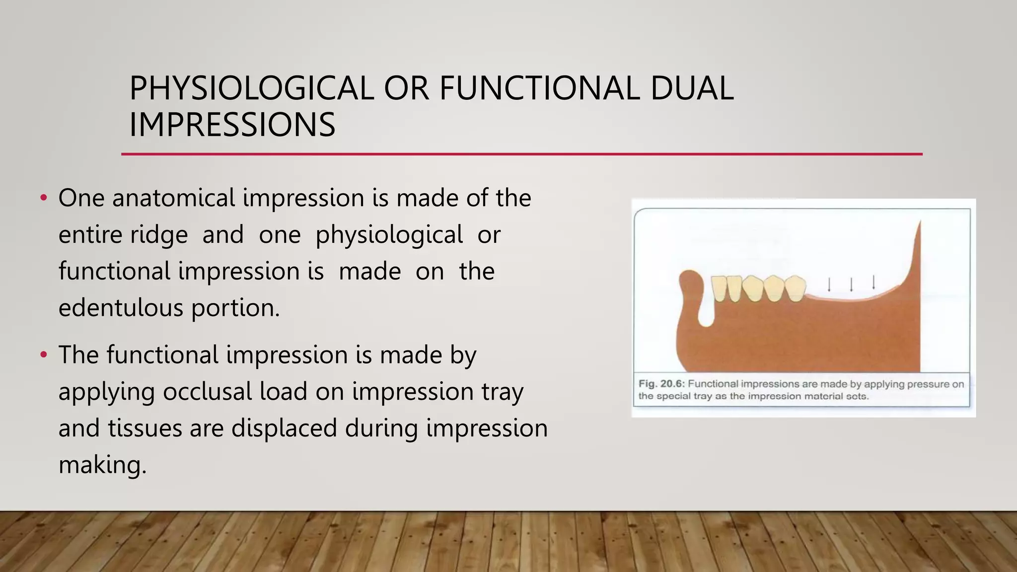Functional impression in RPD | PPTX