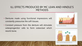 Functional impression in RPD | PPTX