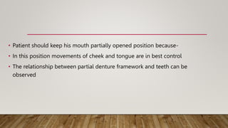 Functional impression in RPD | PPTX