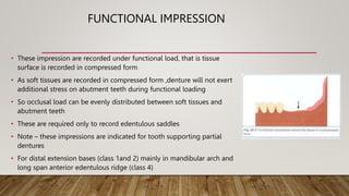 Functional impression in RPD | PPTX