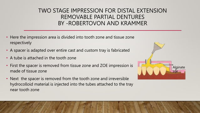 Functional impression in RPD | PPTX | Dental Health | Diseases and ...